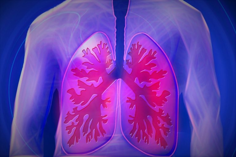 Por Qué Duelen Los Pulmones: Causas, Síntomas Y Tratamientos