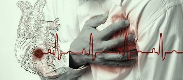 Por Qué Duele El Corazón: ¿Necesario Ataque Cardiaco?